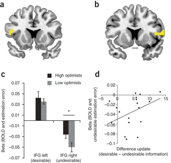 Main-lining the Secret Truth of the Universe: Pessimism and the Brain ...