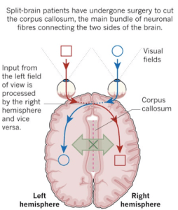 Two brains in one head?: The story of the split-brain phenomenon ...