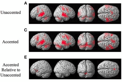What’s in an accent? | NeuWrite San Diego