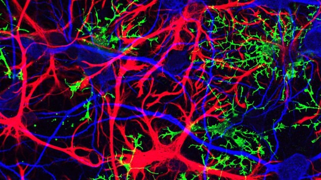 The Scientific Adventures of Ben Barres Part I: Dishing out Discoveries ...