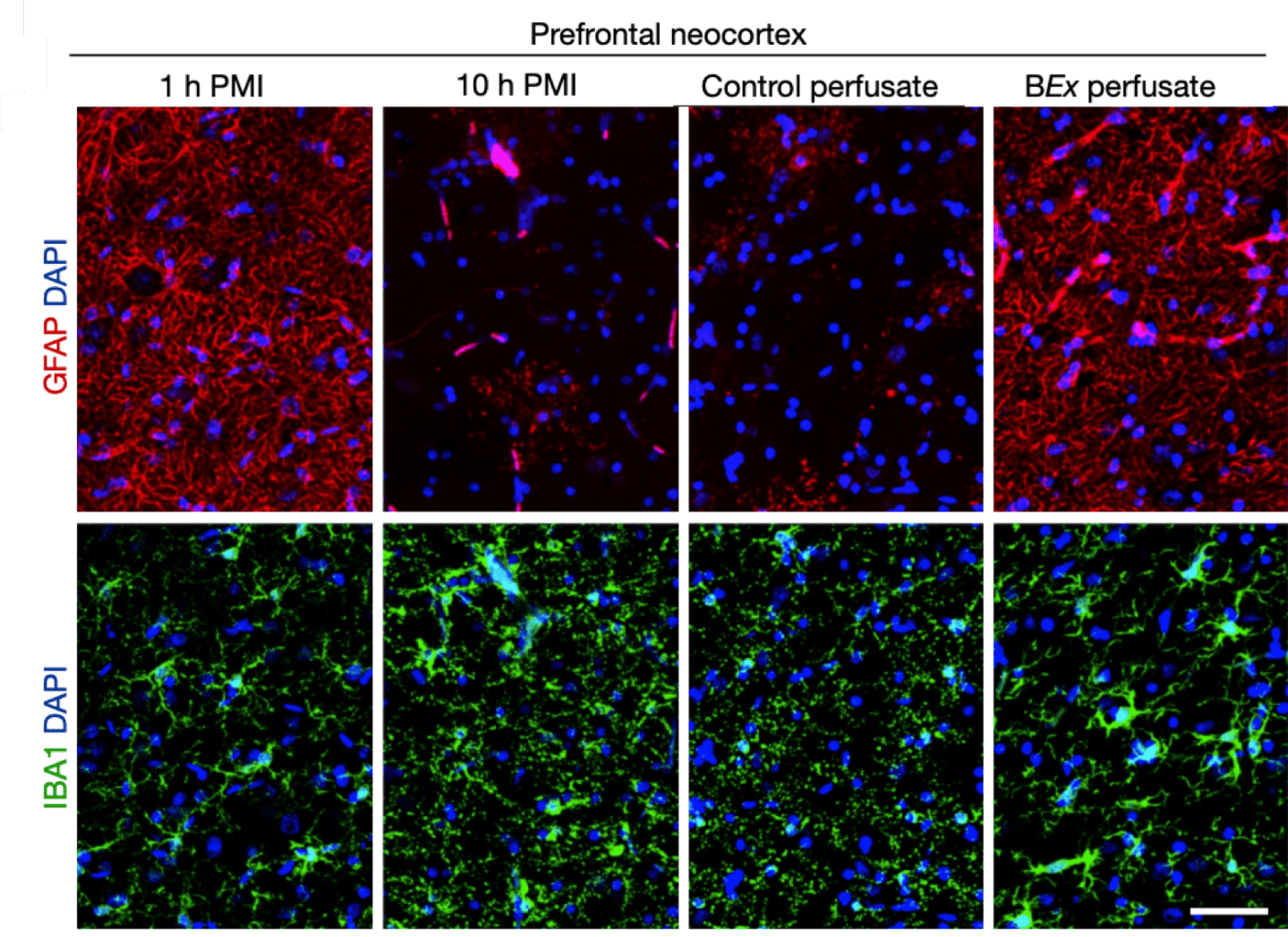 BrainEx: Restoring Brain Circulation After Death | NeuWrite San Diego