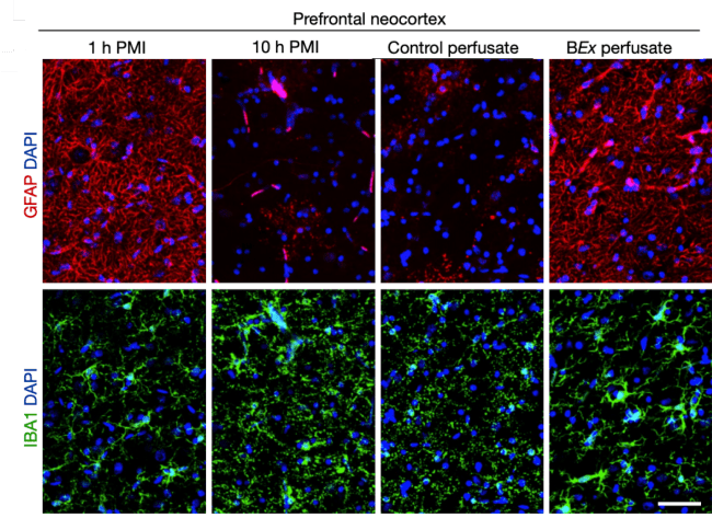 BrainEx: Restoring Brain Circulation After Death | NeuWrite San Diego