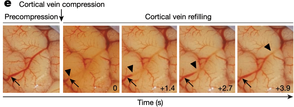 BrainEx: Restoring Brain Circulation After Death | NeuWrite San Diego