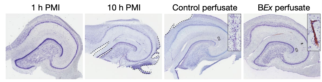 BrainEx: Restoring Brain Circulation After Death | NeuWrite San Diego