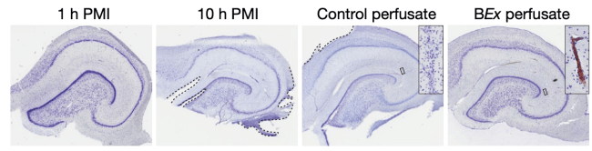 BrainEx: Restoring Brain Circulation After Death | NeuWrite San Diego