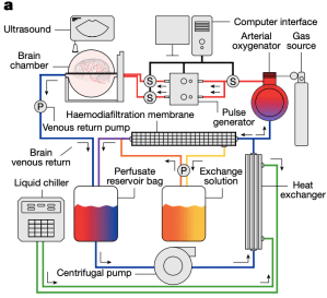 BrainEx: Restoring Brain Circulation After Death | NeuWrite San Diego
