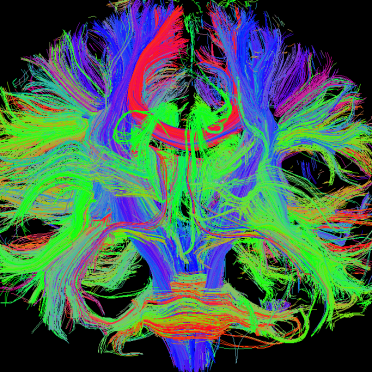 Diffusion MRI: Mapping the structural highways of the brain | NeuWrite ...