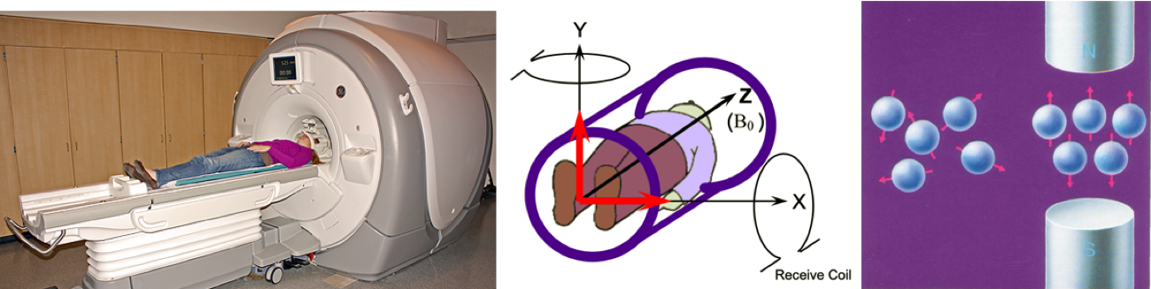 How do we use magnets to take pictures of the brain? | NeuWrite San Diego