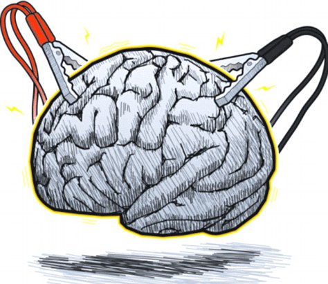 Shocking the brain to protect your memories | NeuWrite San Diego