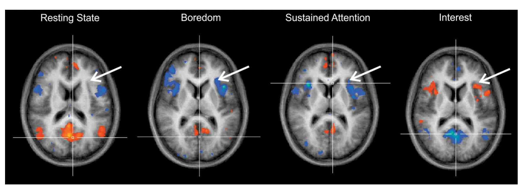 Boredom and the Brain | NeuWrite San Diego